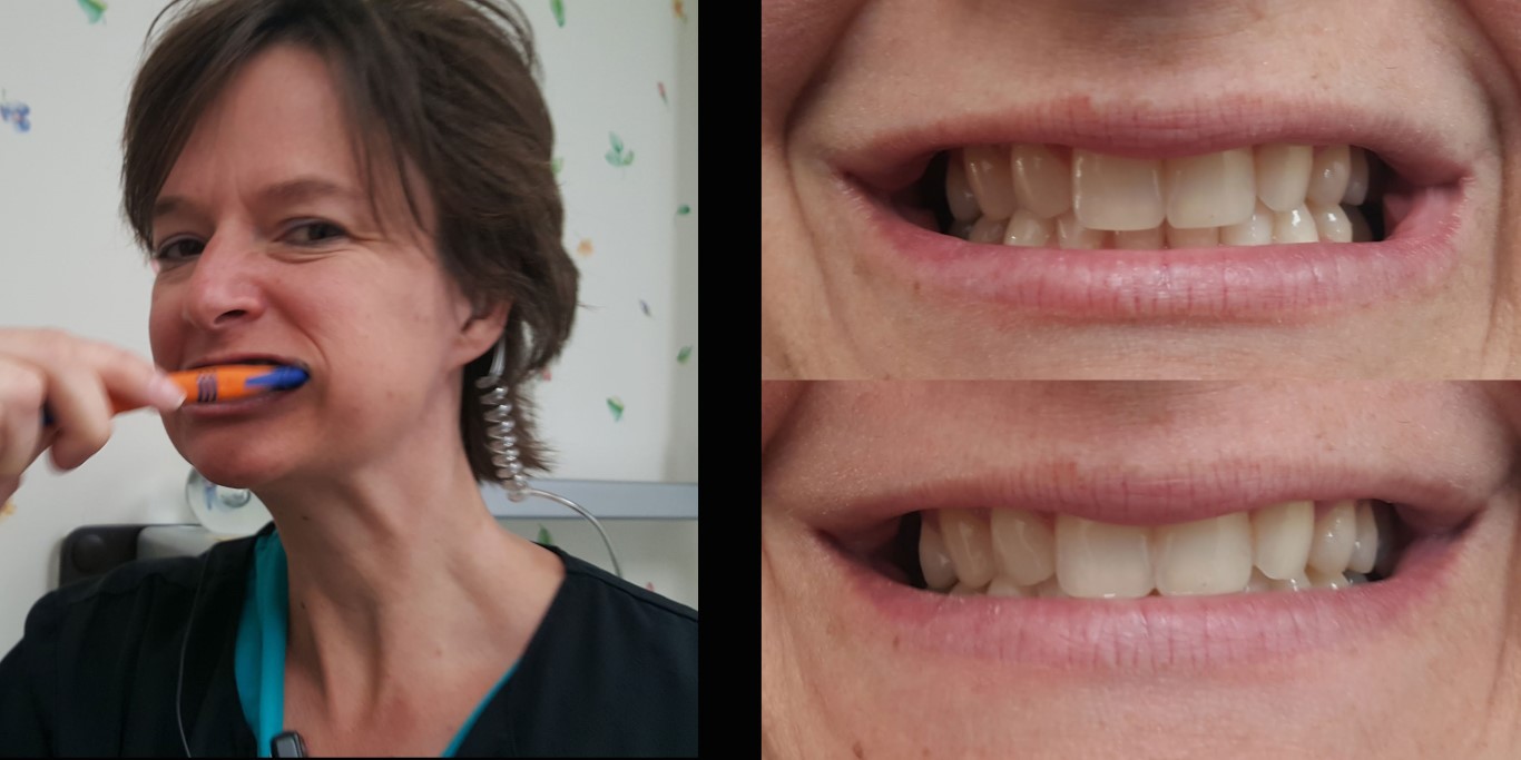 Our office tested a popular charcoal toothpaste – here’s what we found ...