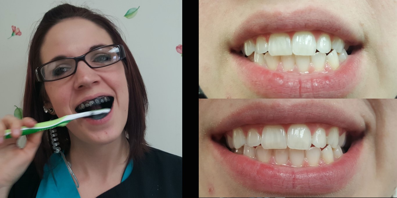 Our office tested a popular charcoal toothpaste – here’s what we found ...