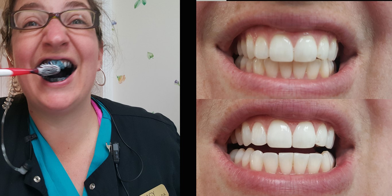 Our office tested a popular charcoal toothpaste – here’s what we found ...
